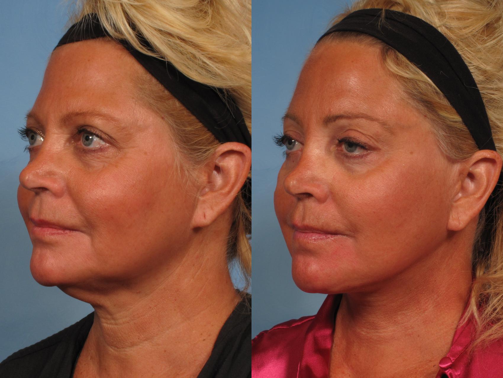 Naples Florida Plastic Surgery